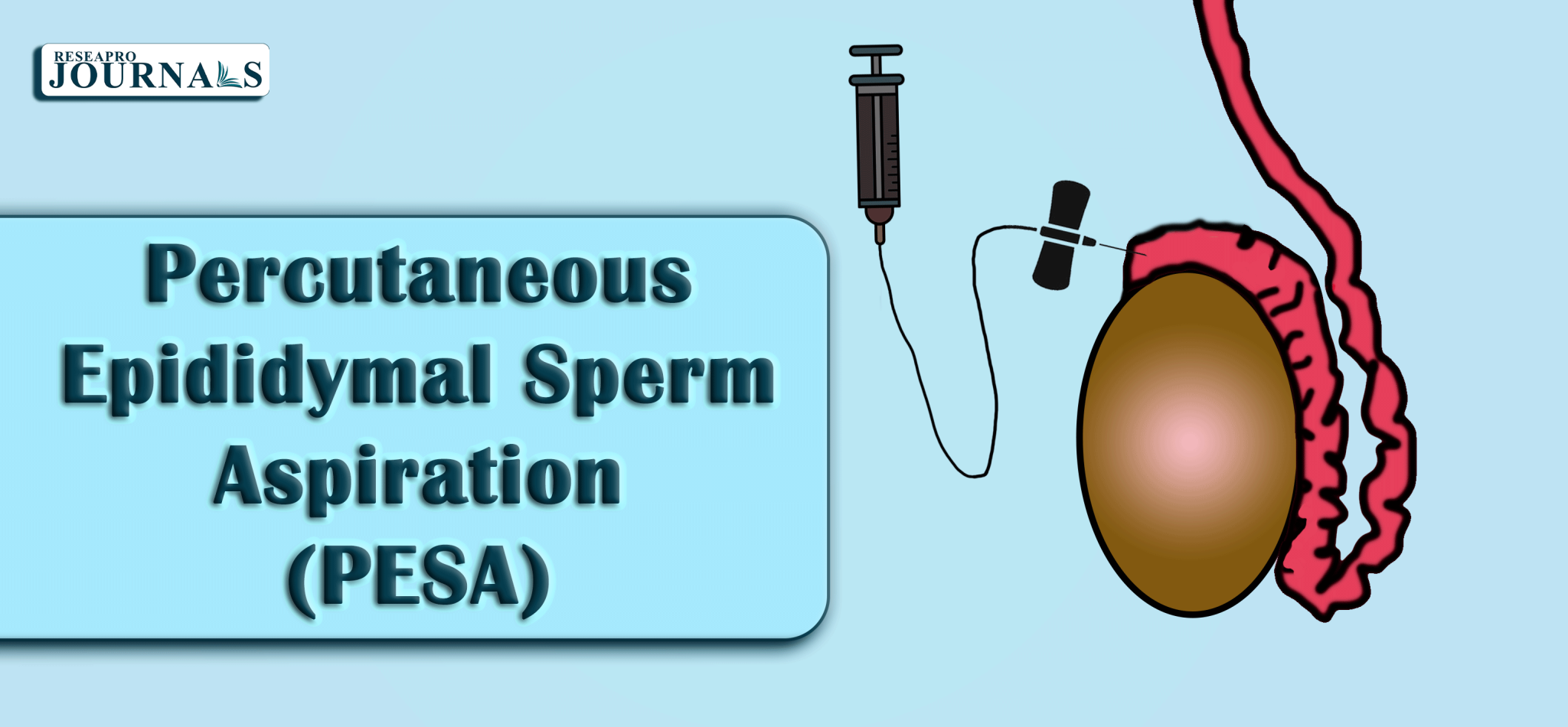 Pesa Redefining Male Fertility Solutions Precision Meets Hope In The